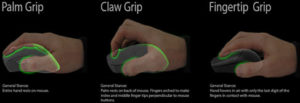 Repetitive Wrist Strain Injury in Gaming - Pivotal Physio