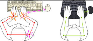 Repetitive Wrist Strain Injury in Gaming - Pivotal Physio
