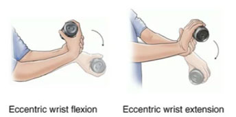 Repetitive Wrist Strain Injury in Gaming - Pivotal Physio